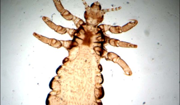 Paduchii, parazitii “nemaipomeniti”