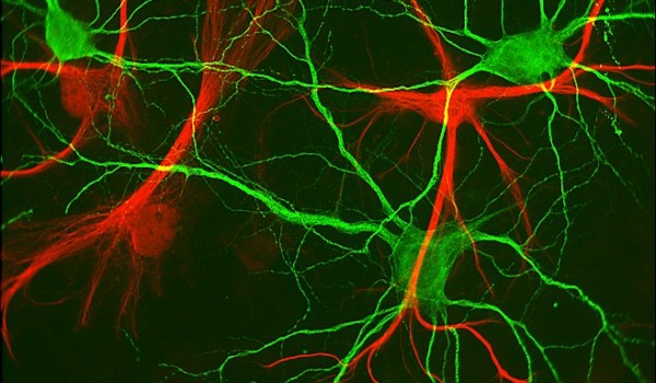 Neuronii nu sunt lasati sa someze - stire in exclusivitate