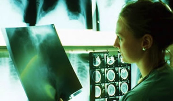 Razele X, cea mai importanta descoperire moderna