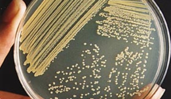 Bacteriile de la locul crimei