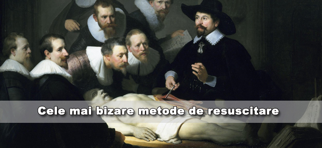 Scurta istorie a celor mai bizare tehnici de resuscitare