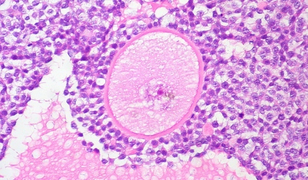 A fost creat ovarul artificial