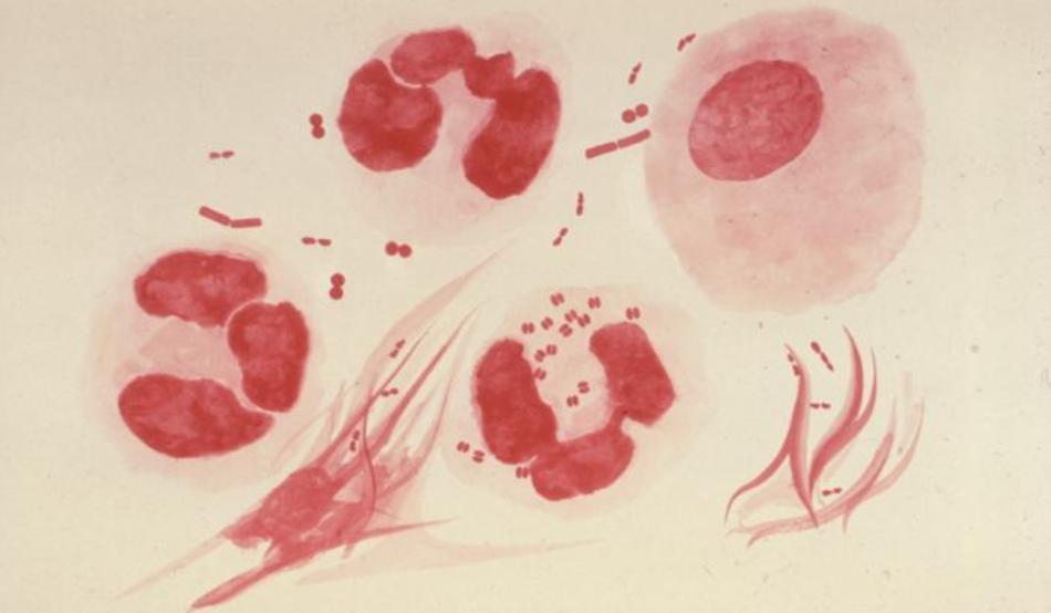 Una dintre cele mai răspândite boli cu transmitere sexuală devine de ...