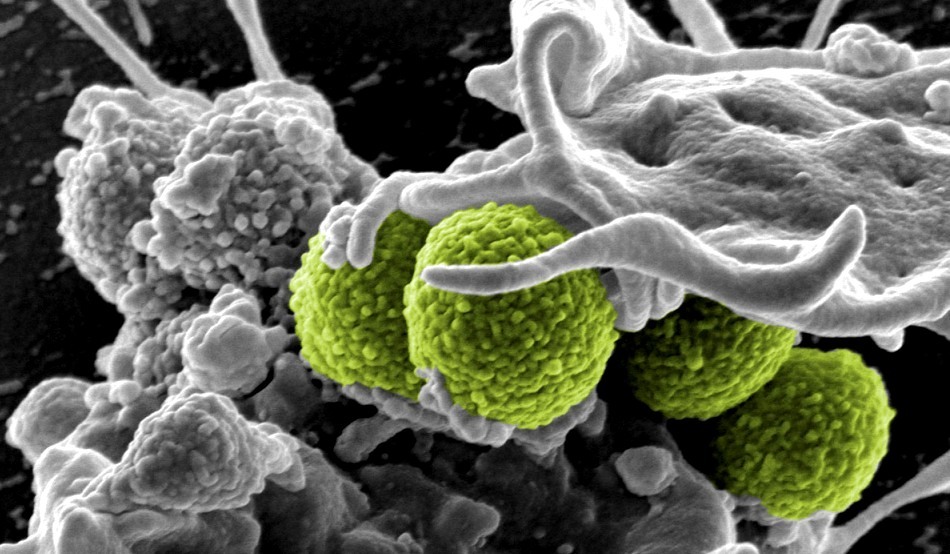 Cum ne apărăm de „super-microbii” rezistenţi la antibiotice?