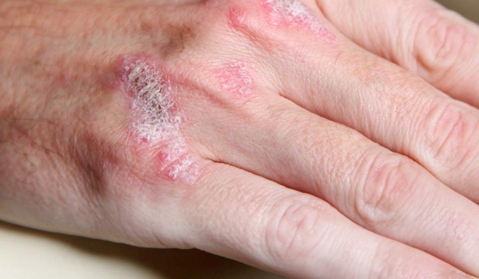 Aparatul care „vede sub piele” îi va ajuta pe medici să diagnosticheze ...