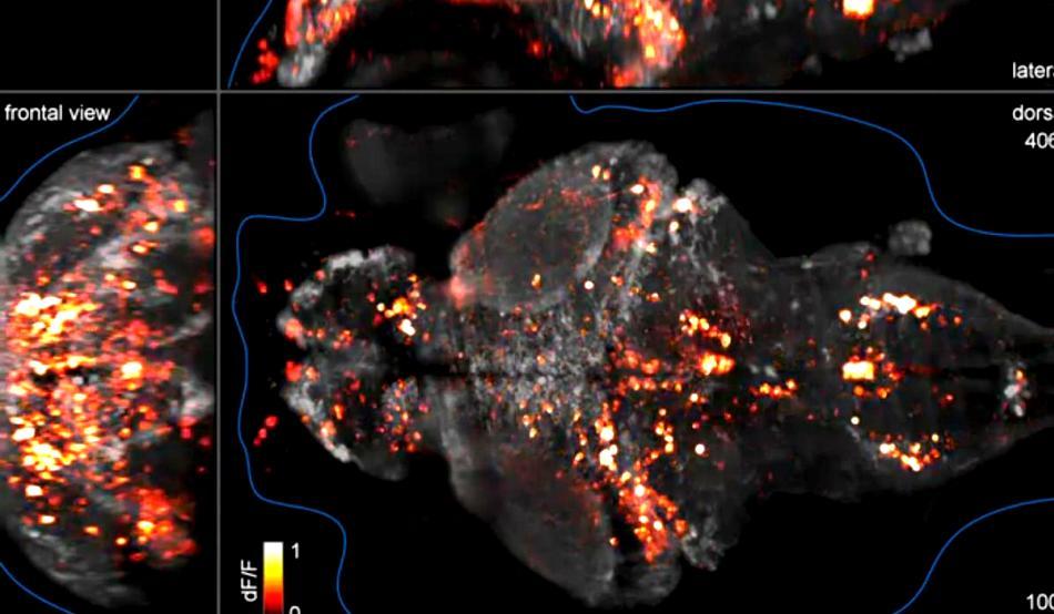 În premieră: întreaga activitate a unui creier a fost înregistrată video!