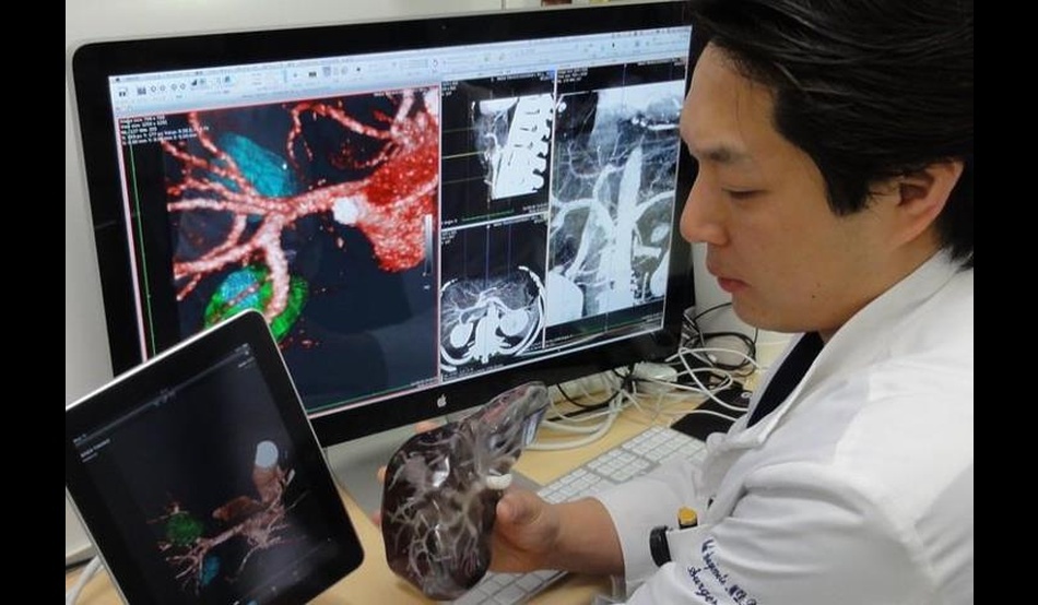 Imprimanta 3D, inovaţia care va schimba complet chirurgia: „E ca ...