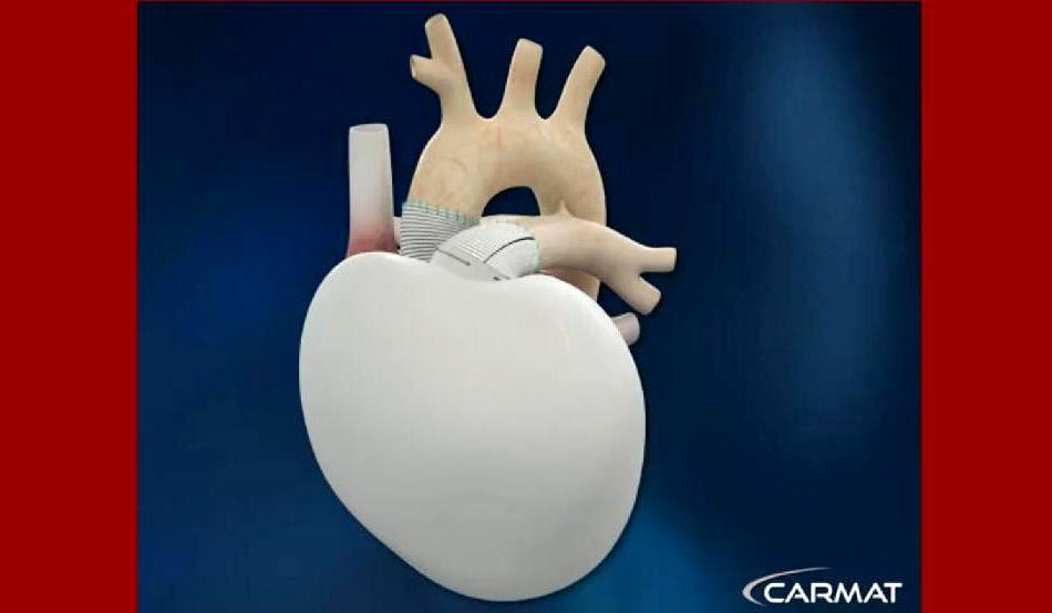 În curând, am putea purta în piept inimi artificiale (VIDEO)