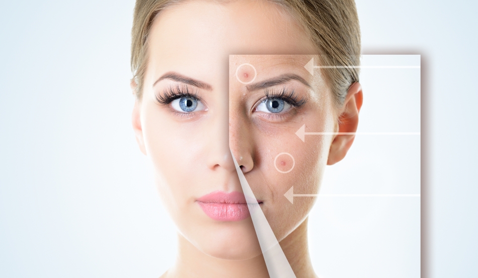 7 mituri despre acnee, desfiinţate de experţi. Cum puteţi scăpa de ...