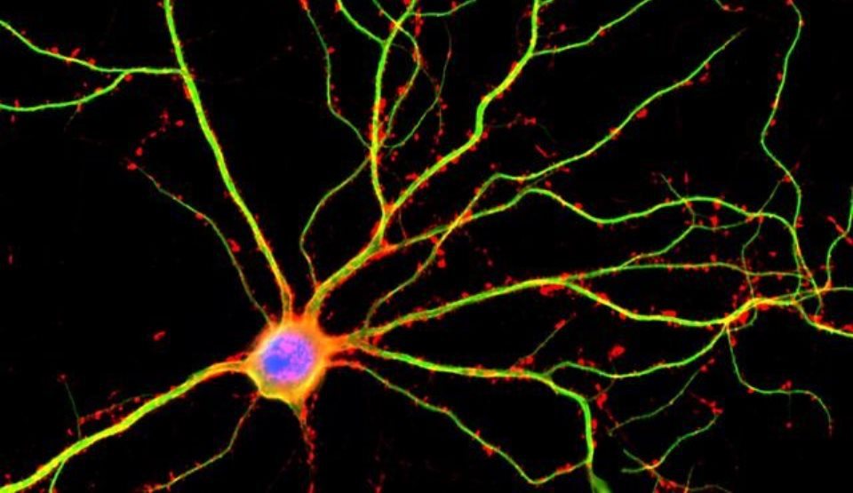 S-a descoperit ''viaţa secretă a neuronilor''! CREIERUL nostru este ...