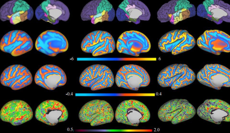 Cum evoluează creierul nou-născuţilor? Cercetătorii au scanat creierul ...