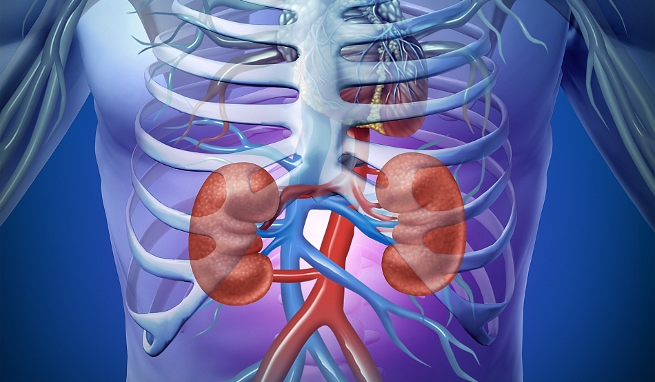 Tot ce trebuie să ştii despre litiaza renală: simptome, tipuri ...