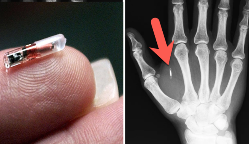 Într-o ţară europeană, oameni au început să-şi implanteze microcipuri ...