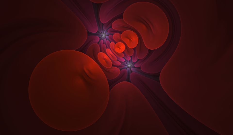 Un nivel mare de fier în sânge combate anemia, dar are alte efecte adverse