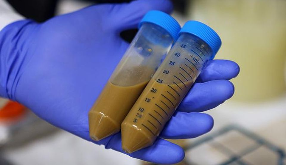 A fost înregistrat primul deces din cauza unui transplant de materii fecale