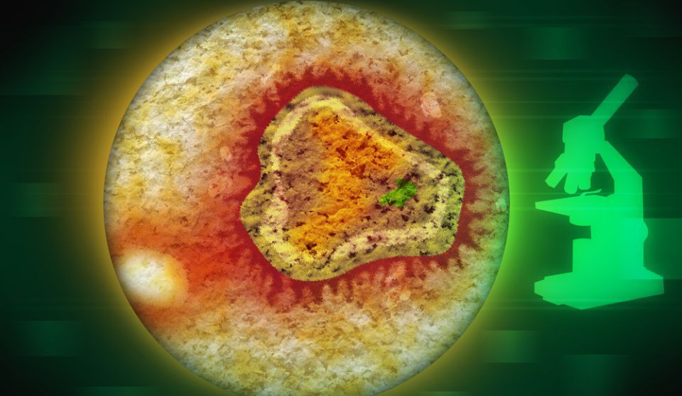 Cele mai periculoase 12 virusuri din istorie