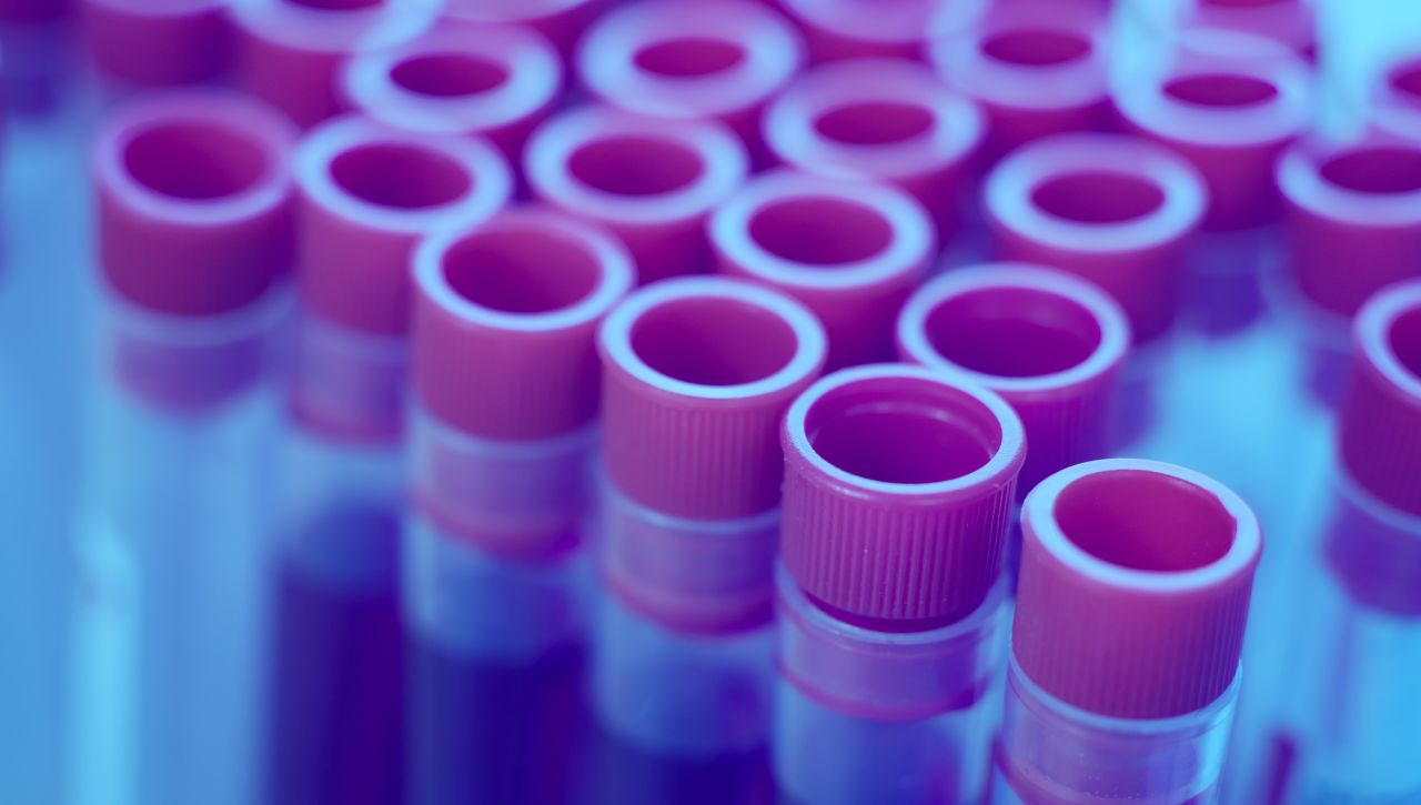 Un test de sânge depistează 5 tipuri de cancer cu până la patru ani ...