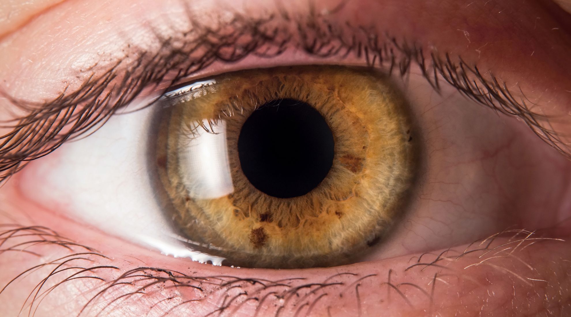 Un nou tratament pentru cel mai frecvent cancer la ochi