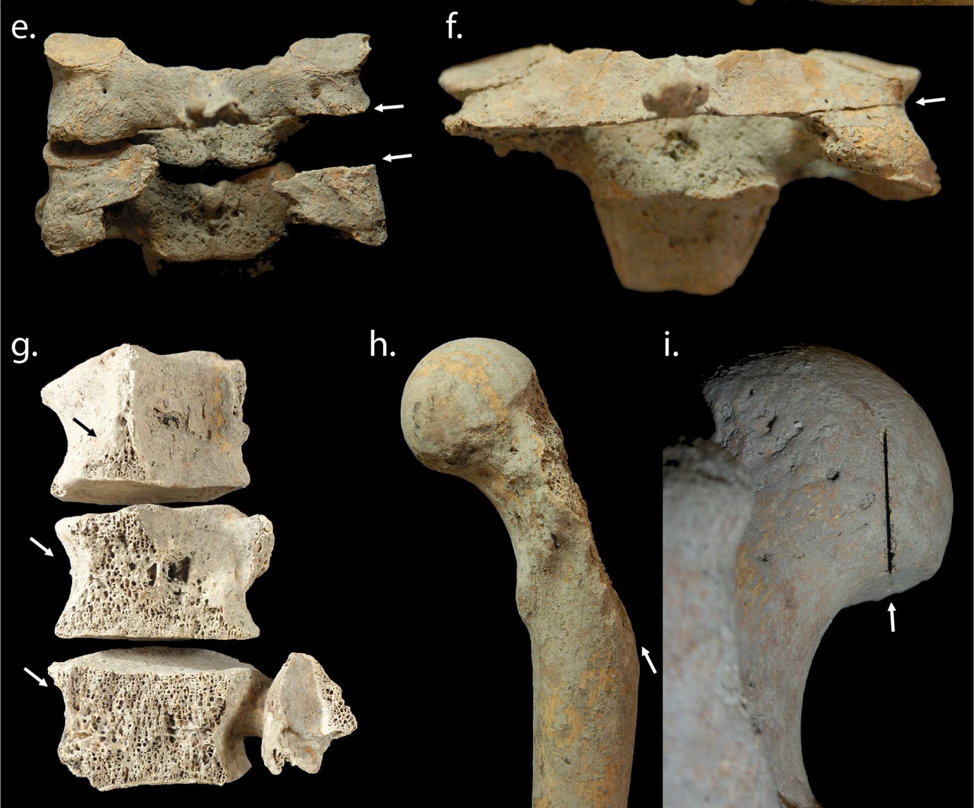 Mormânt comun găsit în Liban arată realitatea crudă a războiului medieval