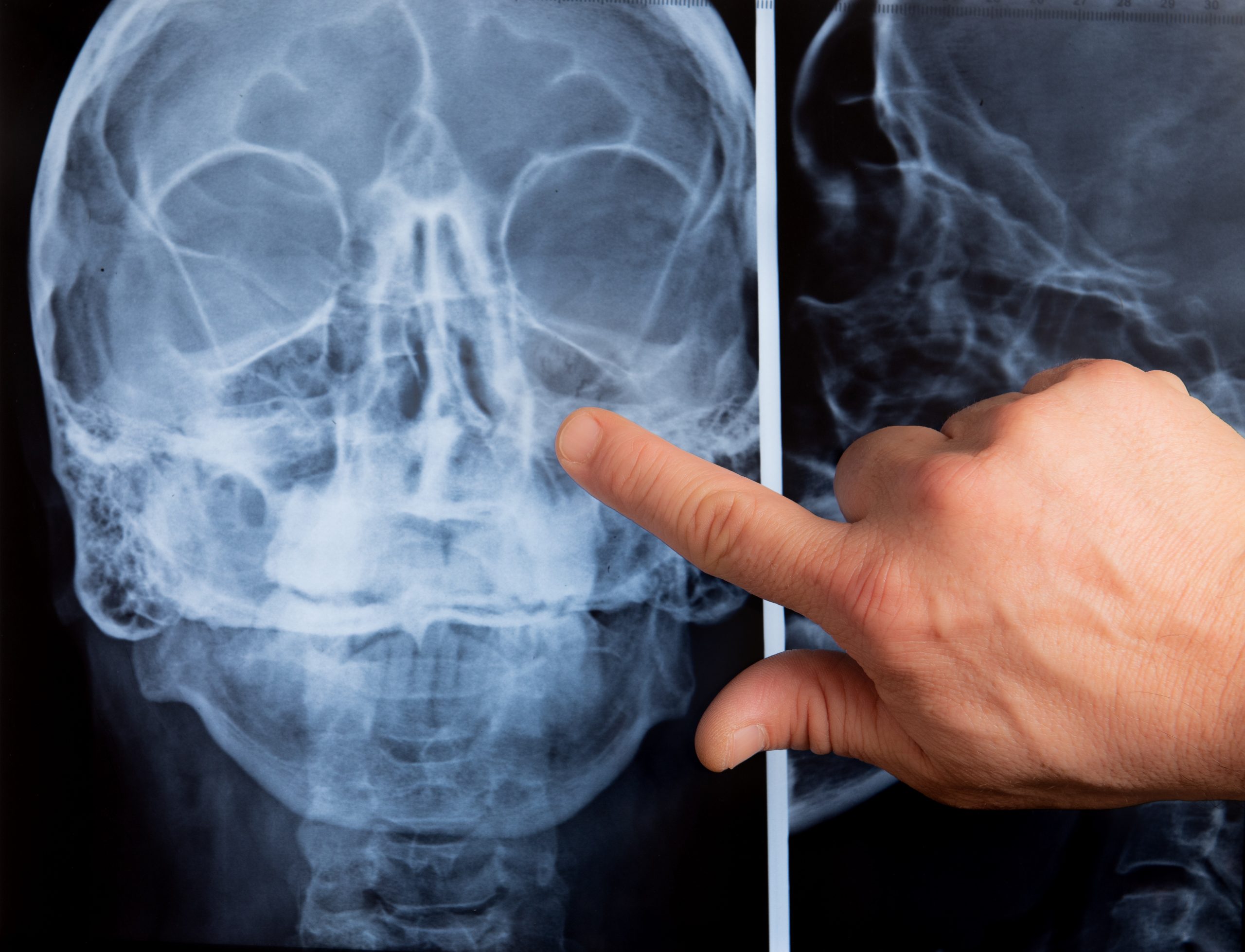 Simțul nostru al mirosului este un sistem de avertizare surprinzător de ...