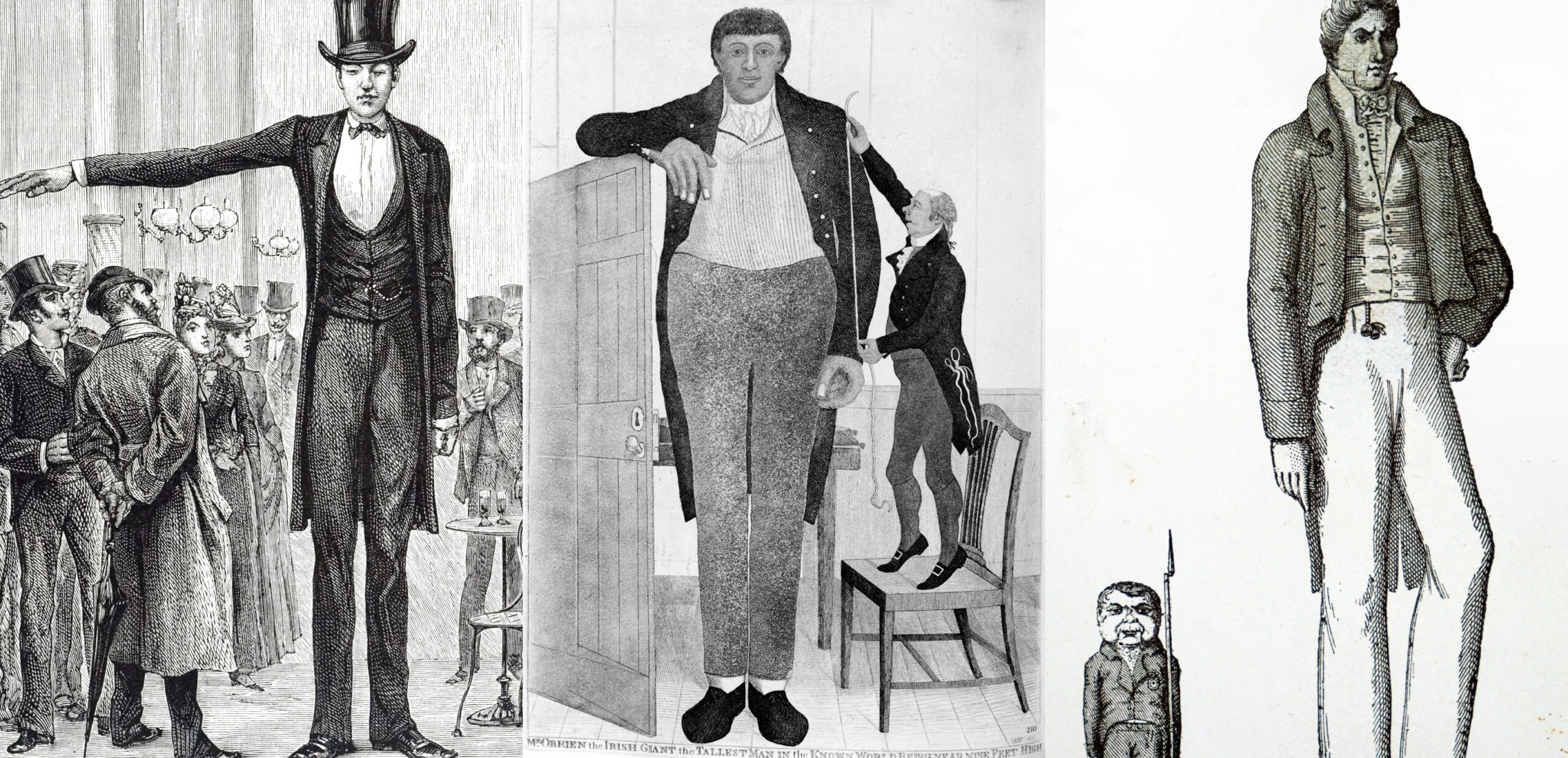 Adam Rainer, un caz unic în istorie. S-a născut pitic, a murit uriaș