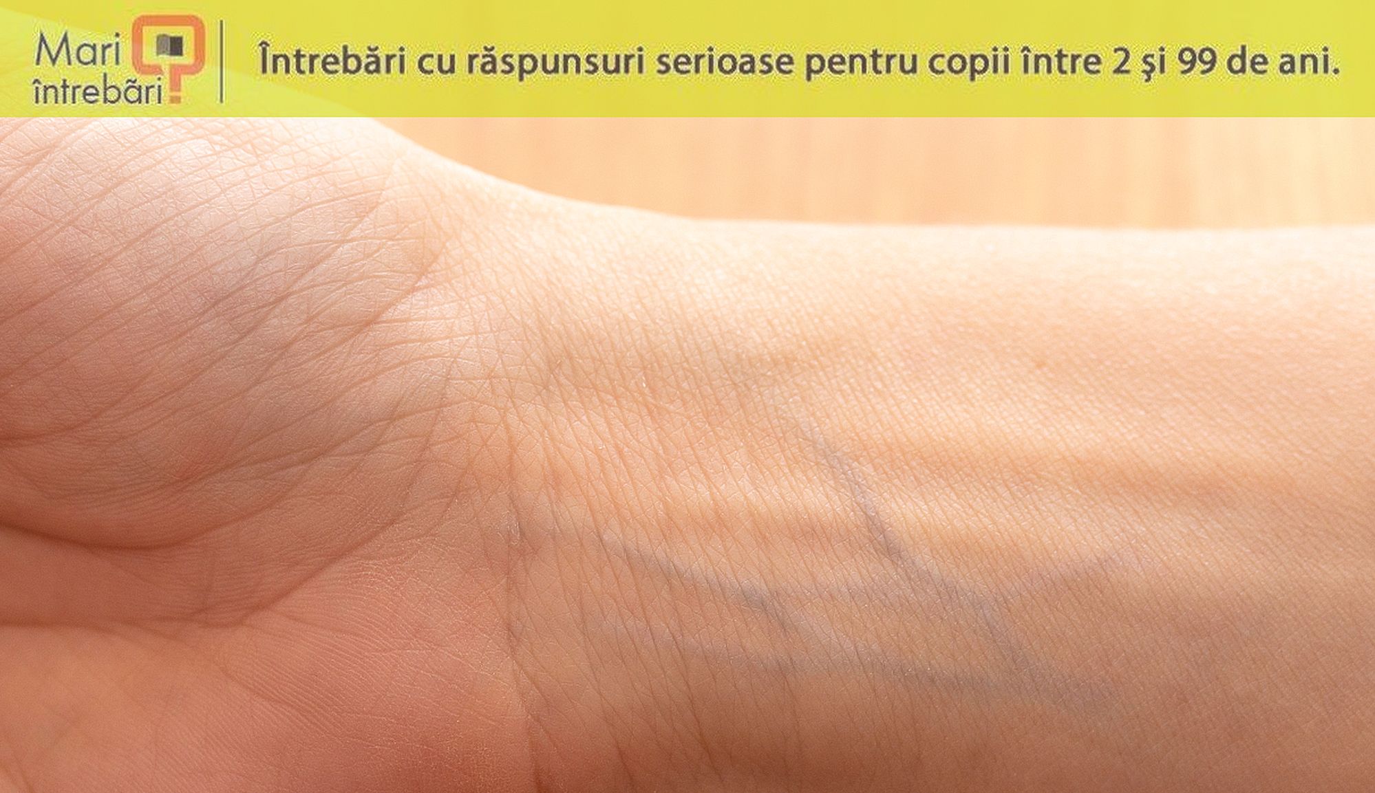 De ce venele sunt greu de găsit la unii oameni?