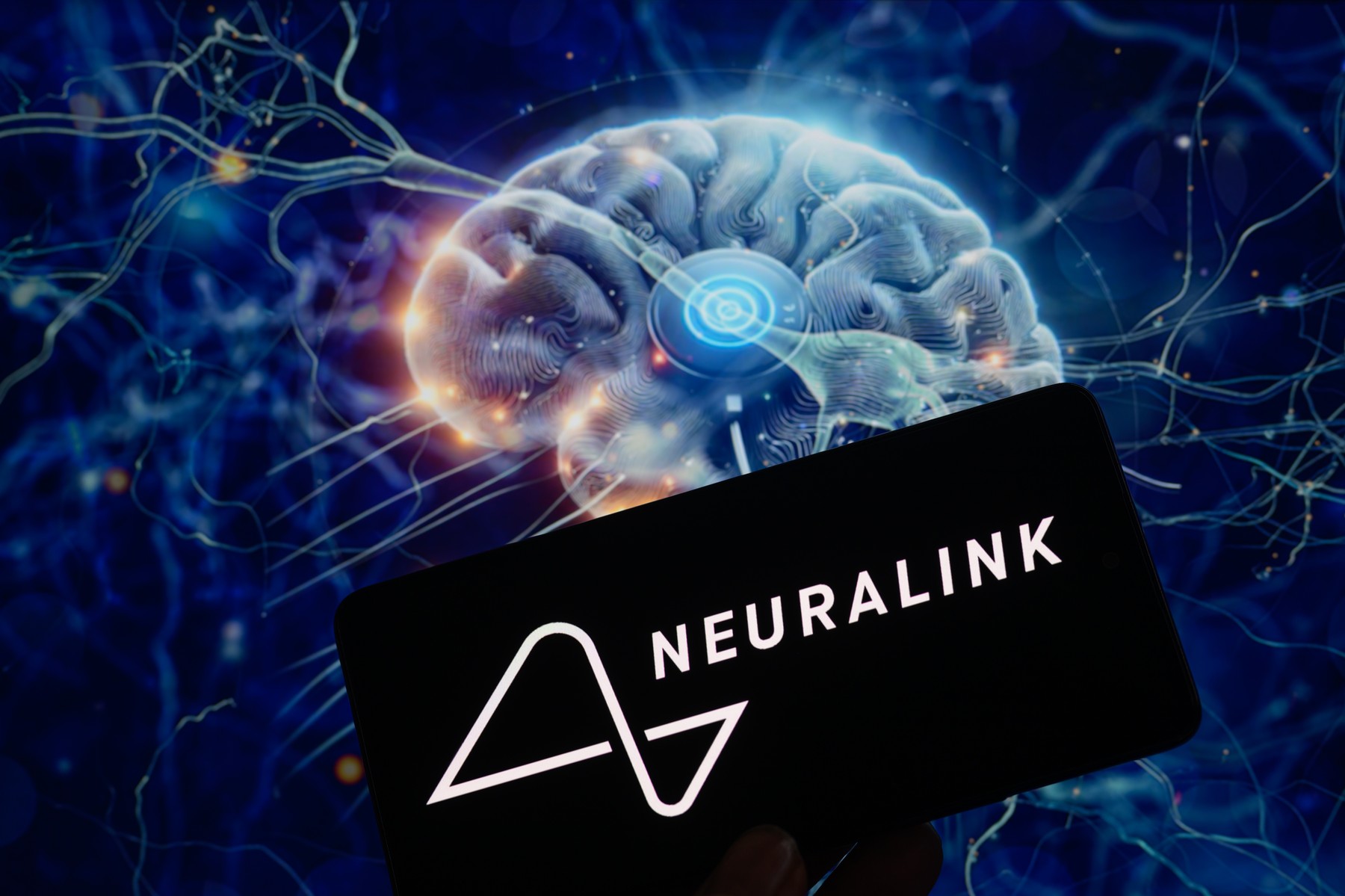 Elon Musk crede că Neuralink va putea „vindeca” orbirea și paralizia