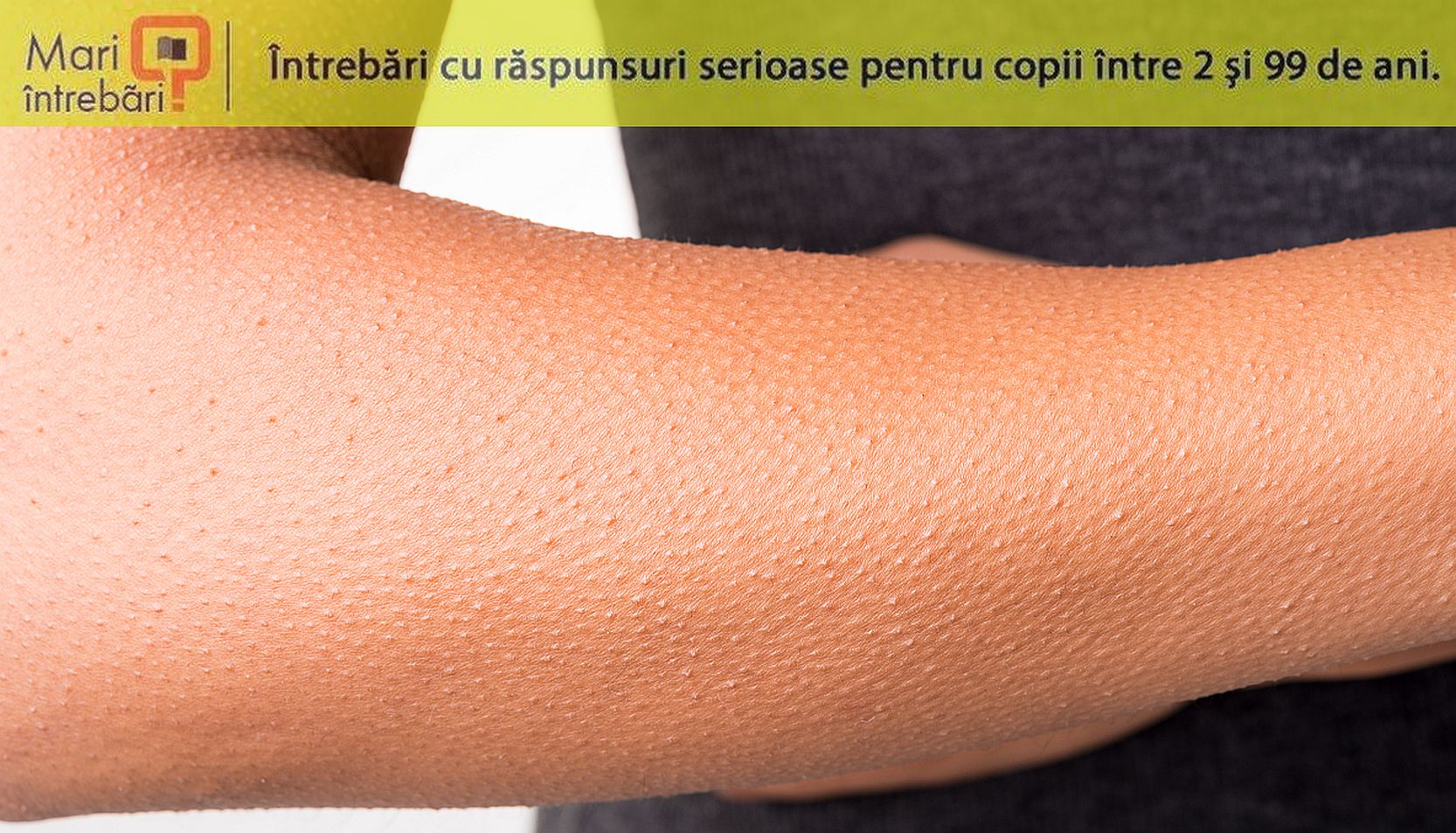 Ce este și cum apare „pielea de găină”?