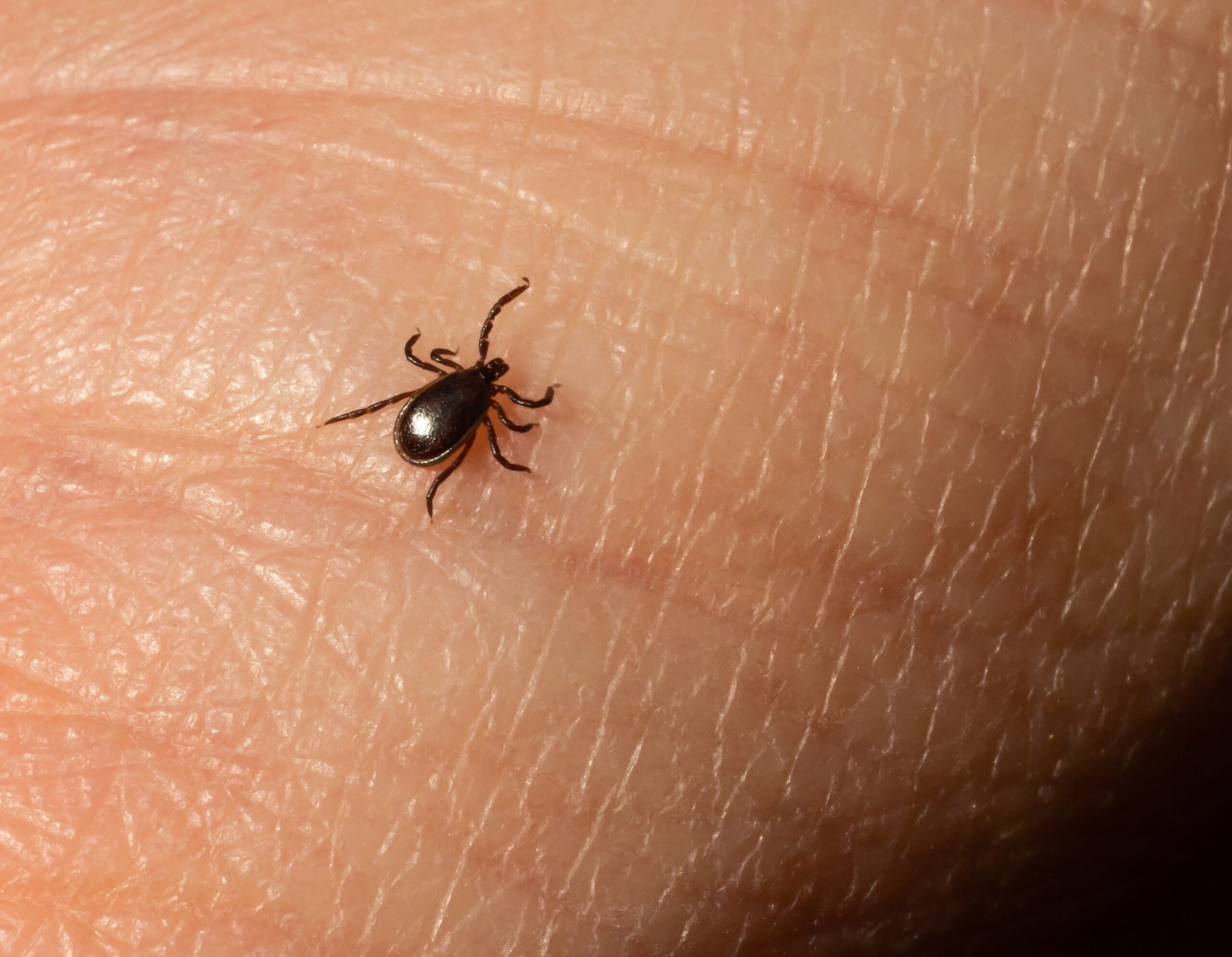 Inteligență Artificială detectează boala Lyme cu o precizie de 90%