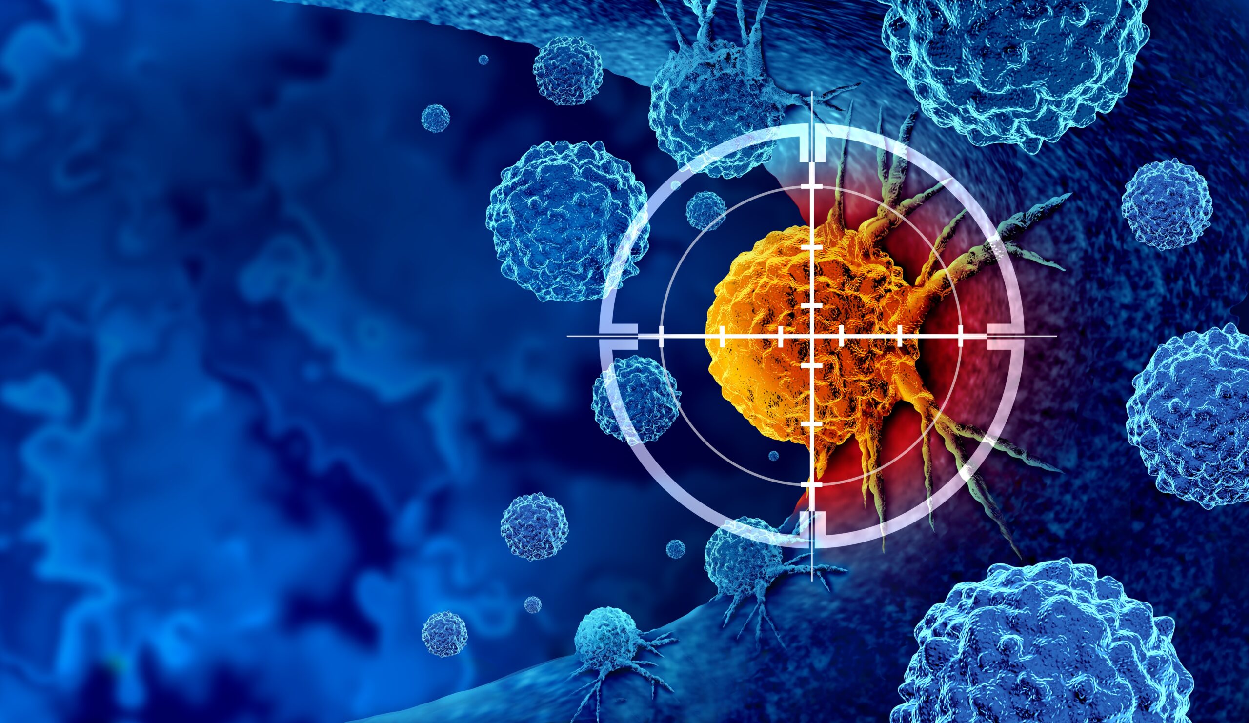 40% dintre cazurile de cancer pot fi prevenite. Ce factori de risc ...